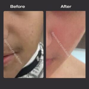 Results - Primal Revolution