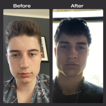 Results - Primal Revolution